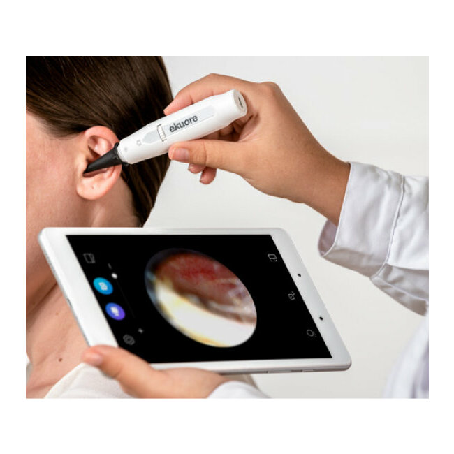 eKuore Otoscope Pro Numérique Médical